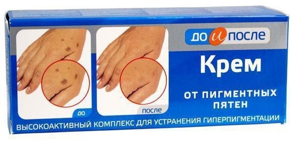 Купить До и После От пигментных пятен крем для тела 50 мл в Алматы